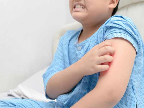 Itchy Skin? Try These 5 Effective Natural Remedies - Elite Hydration IV
