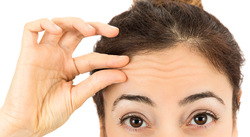 How to Calculate the Right Botox Units for Forehead Wrinkles - Elite ...