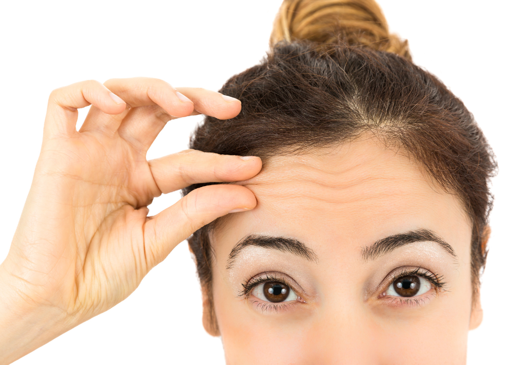 How to Calculate the Right Botox Units for Forehead Wrinkles - Elite ...
