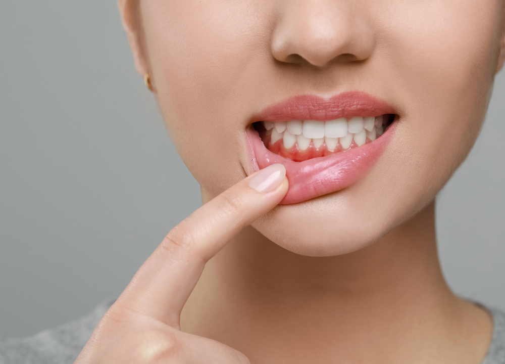 Why Do My Gums Hurt When I Touch Them? Causes and Solutions - Elite ...