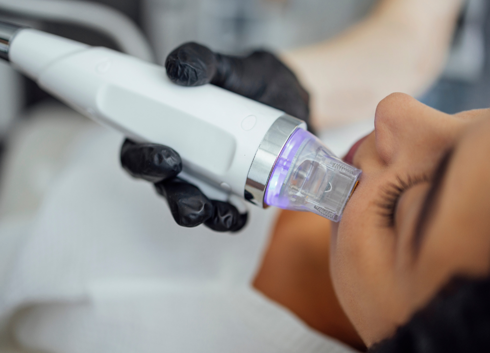 When can you do Microneedling After Botox Injections? - Elite Hydration IV