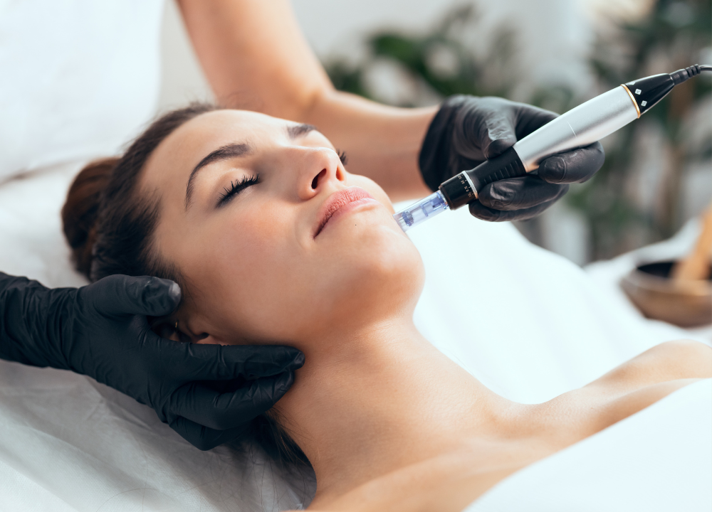Microneedling Benefits: More Than Just Skin Deep – Elite Hydration IV