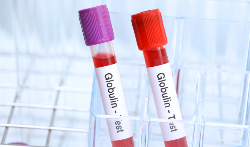 What Does Low Beta-1 Globulin Mean? A Simple Guide – Elite Hydration IV