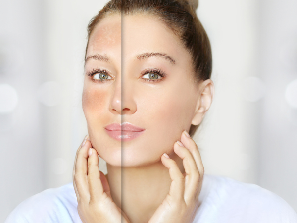 How to Spot Early Signs of Skin Damage - Elite Hydration IV